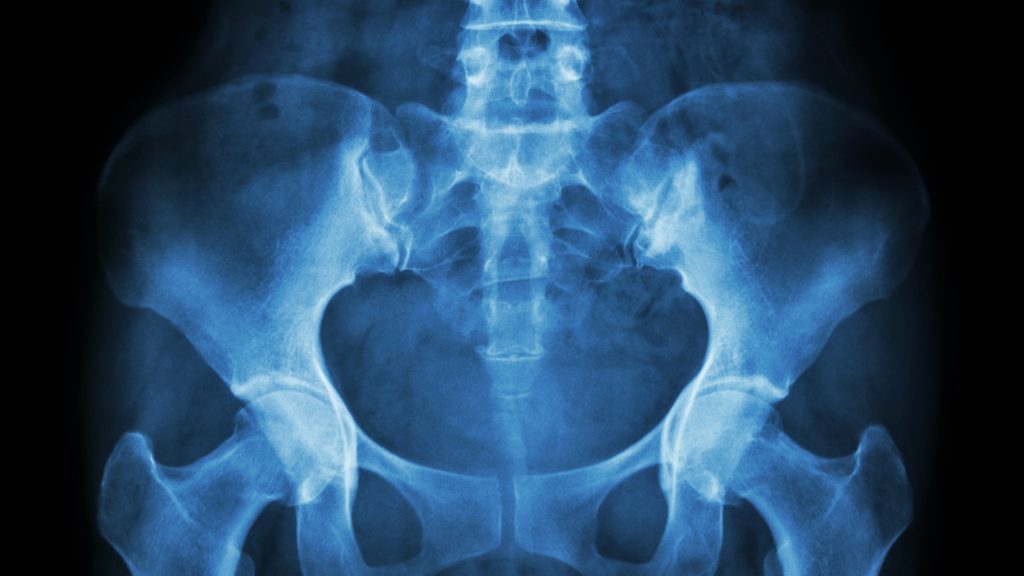 The Power of the Pelvis – Himalayan Institute Online